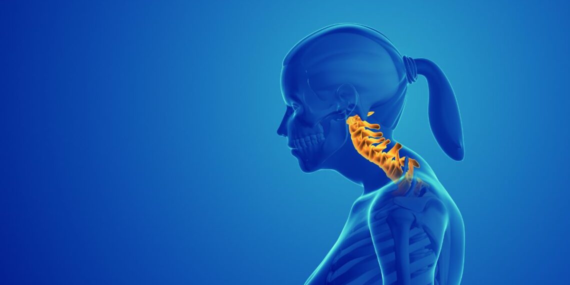 Understanding Turtle Neck Syndrome: Causes and Symptoms